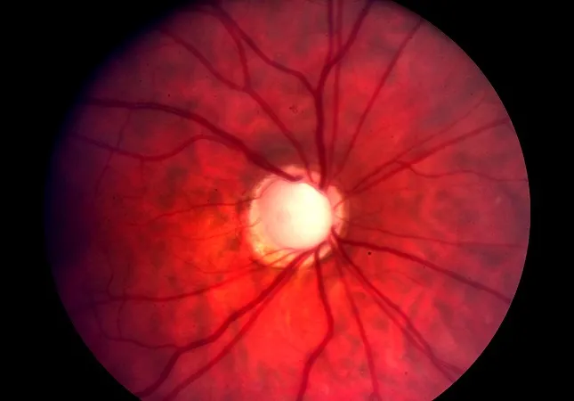 Tau protein dysregulation in glaucomatous neurodegeneration